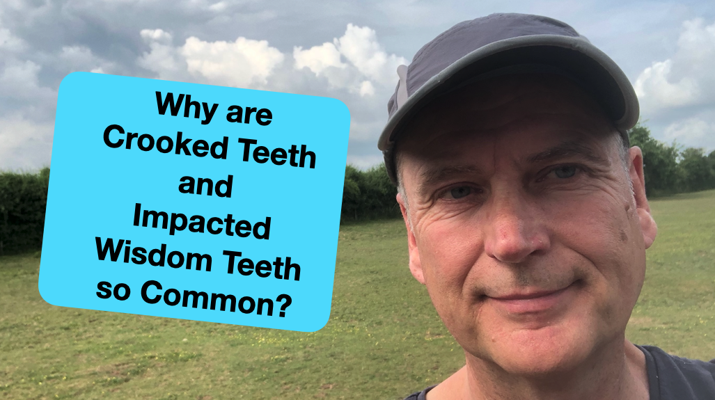 A hidden epidemic: Beyond crooked teeth and impacted wisdom teeth ...